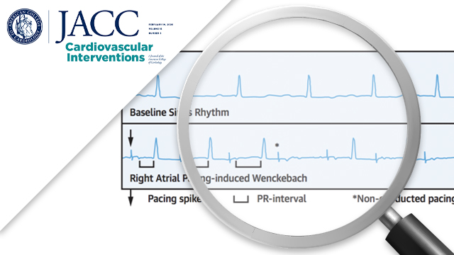 The utility of rapid atrial pacing immediately post-TAVR to predict the ...