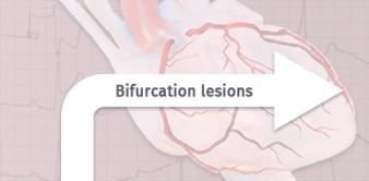 Coronary Interventions