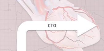 Coronary Interventions