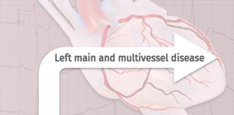 Coronary Interventions