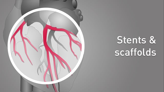 Stents, scaffolds and DCB