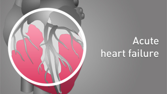 Interventions for Heart Failure