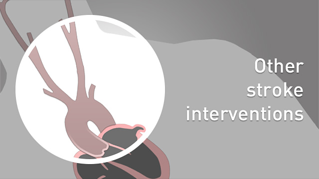 Other stroke interventions