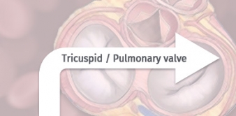 Valvular Interventions