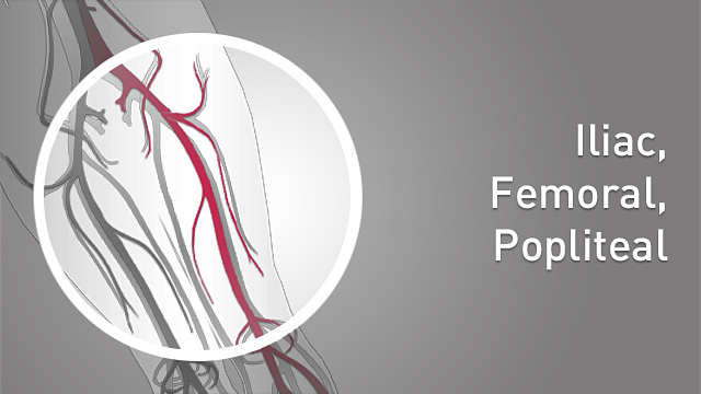 Iliac / Femoral / Popliteal