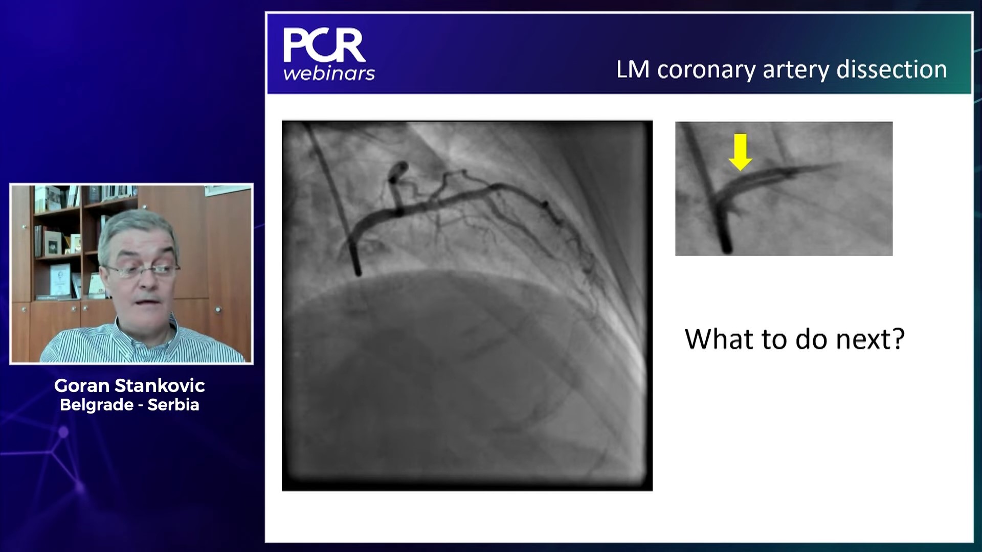 How should I prevent and manage complications when performing left main ...