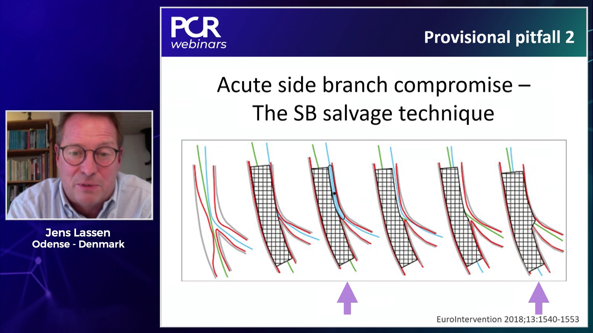 How should I improve the results of provisional side branch stenting?
