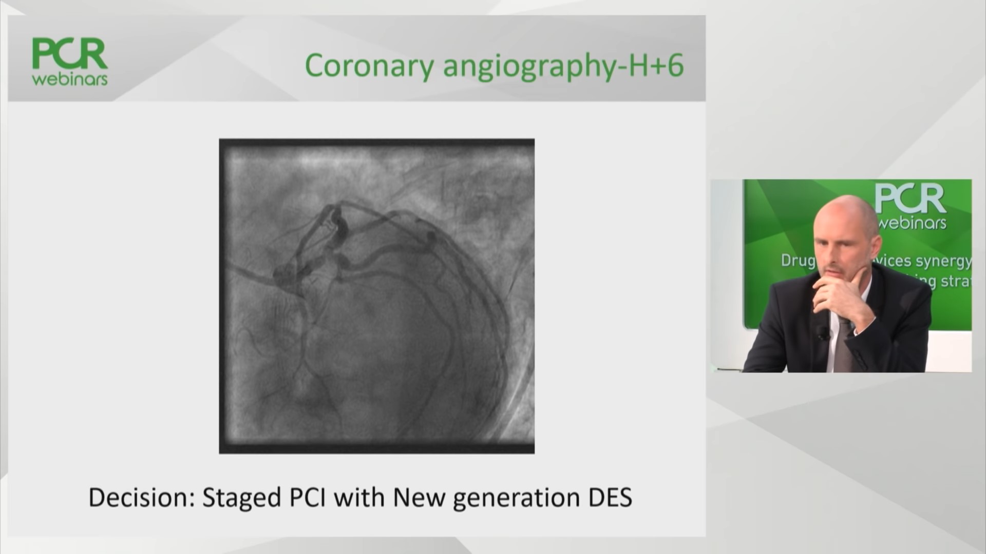 Drugs and devices synergy: optimal DAPT & switching strategies