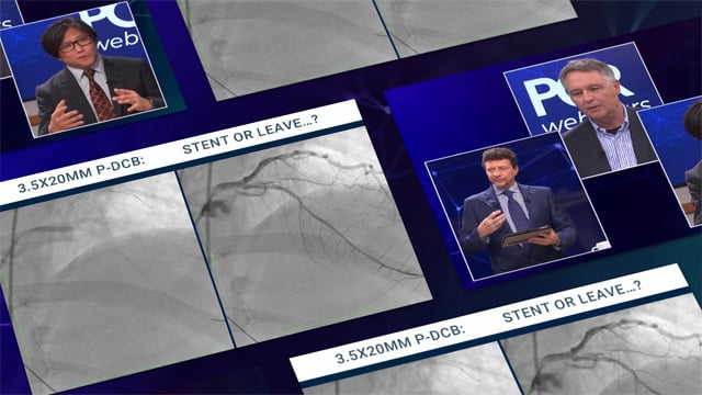 Stent or Leave: considerations for a successful DCB PCI
