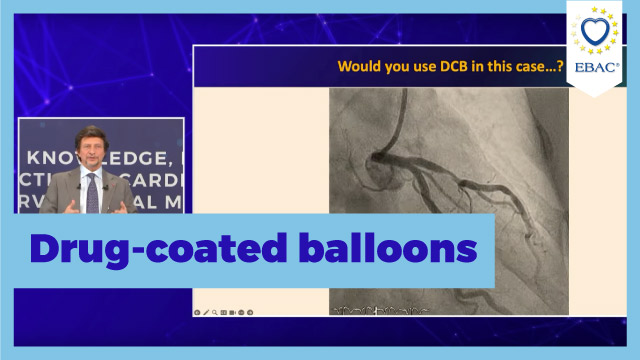 Treating patients with drug-coated balloons – what is the optimal result?