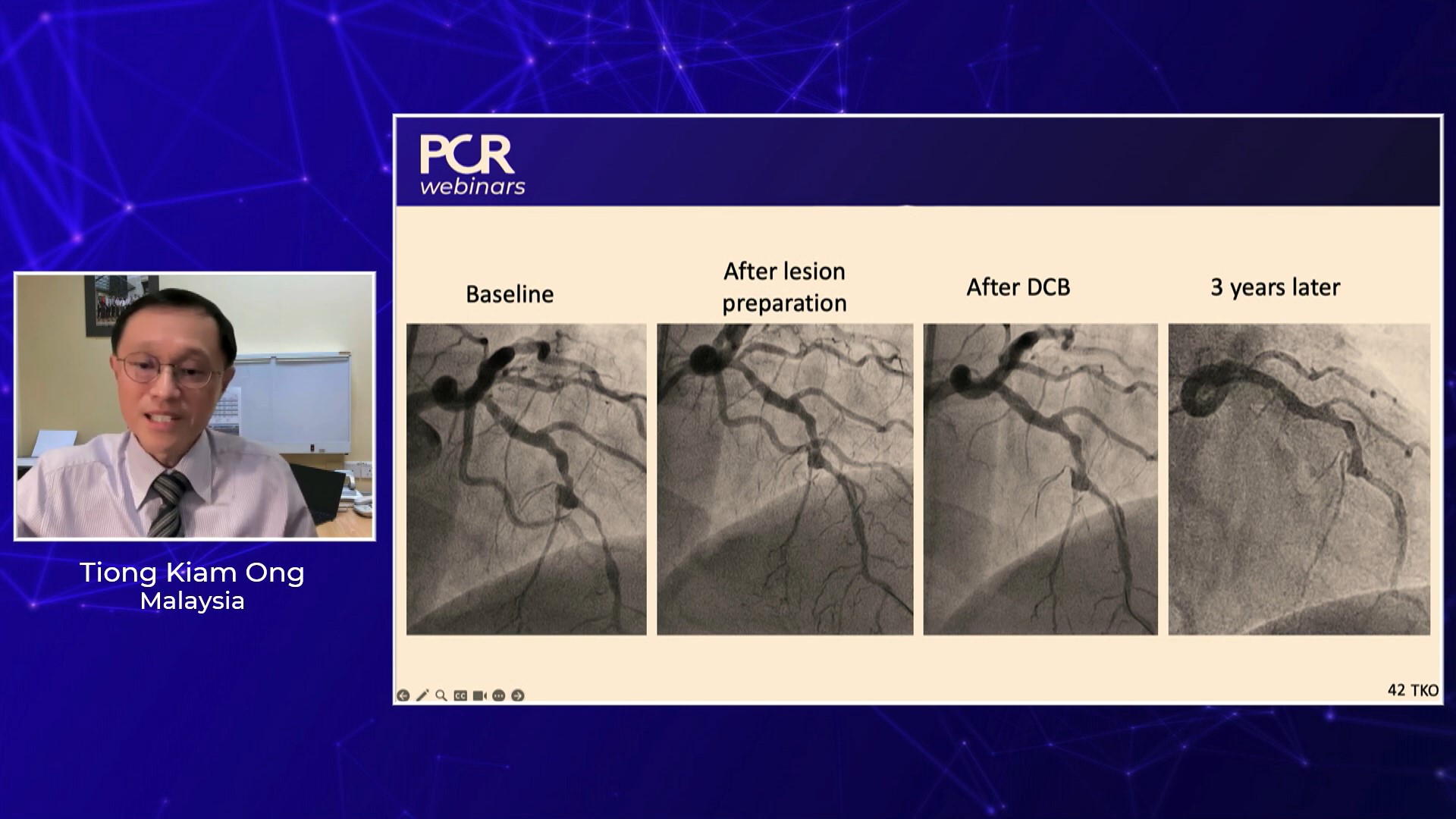 Why and when to use DCB?