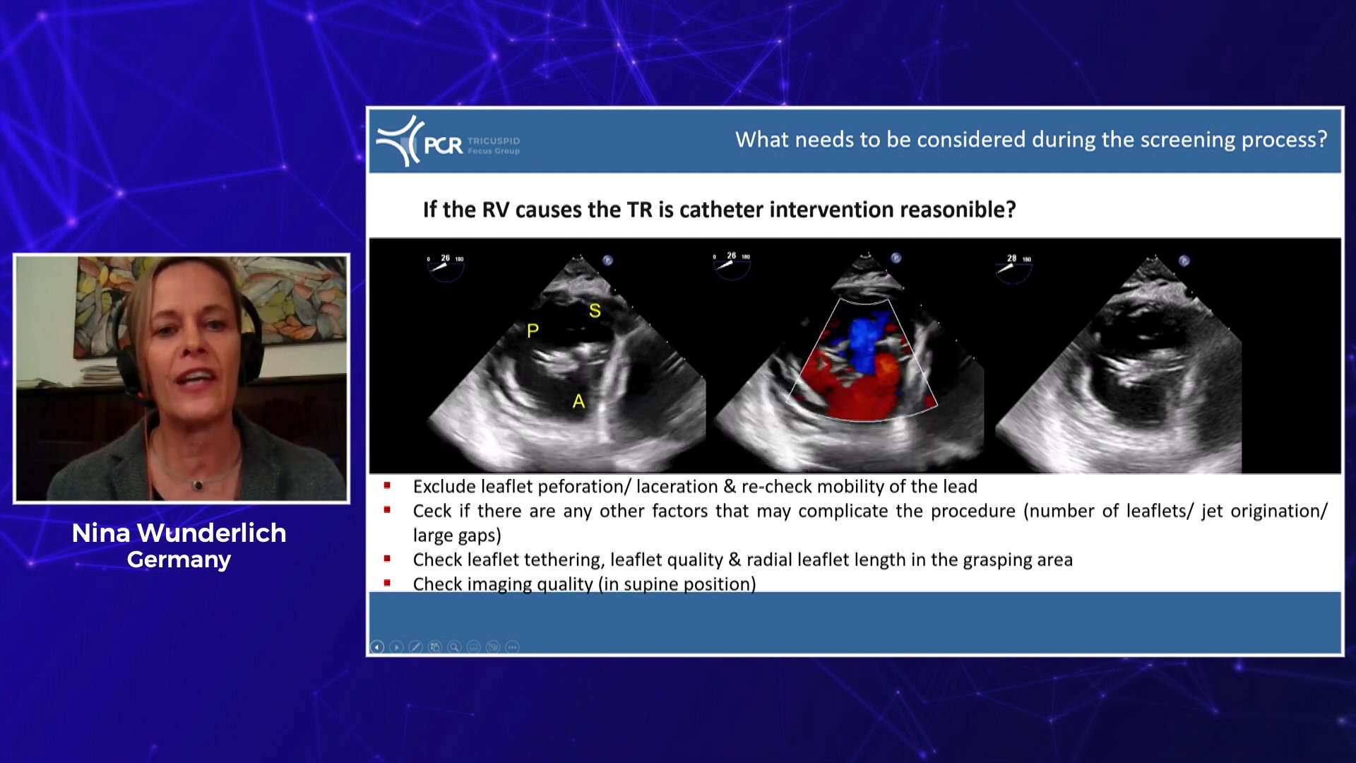 Rhythm management in patients with tricuspid regurgitation